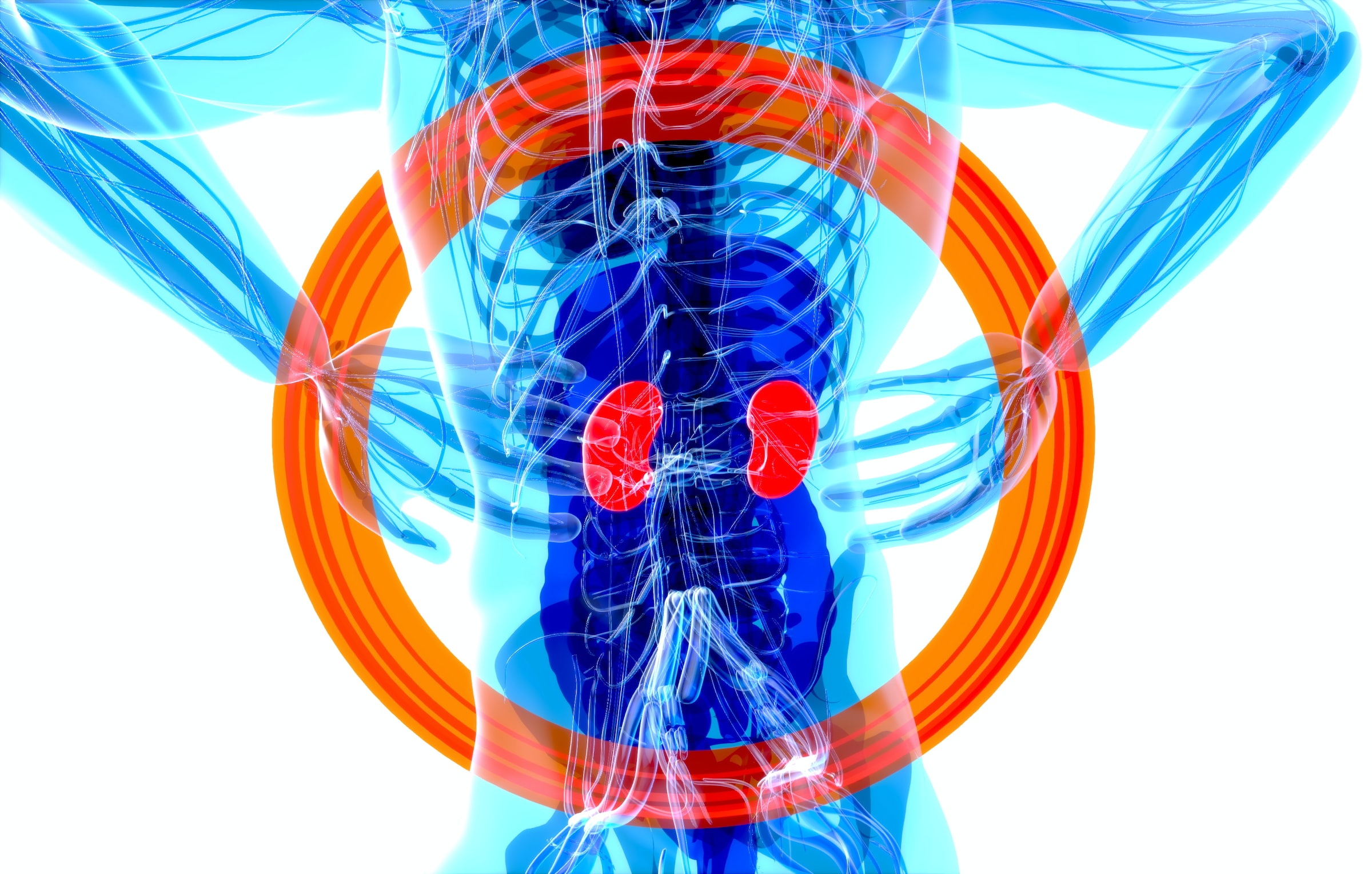 Robotic kidney cancer surgery yields positive results - Surgery ...