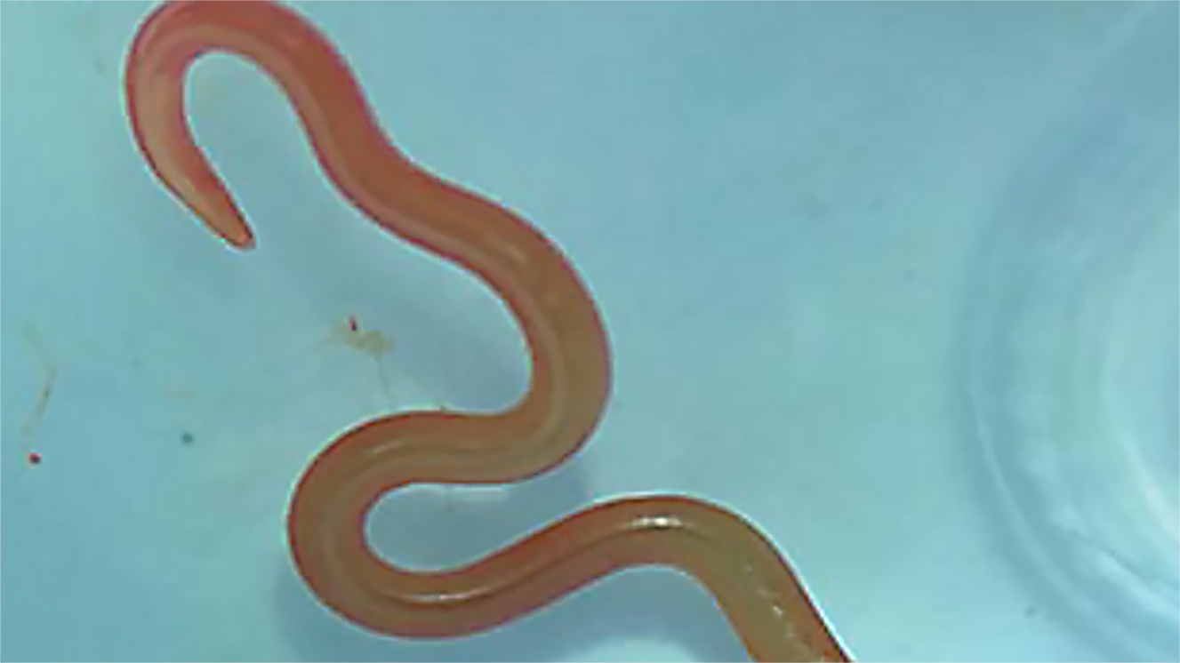 Neurosurgeon removes worm from brain - Surgery International