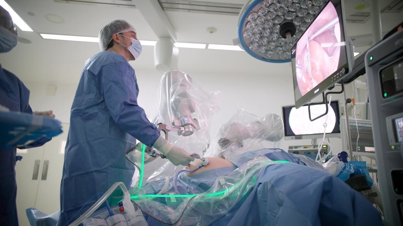 AI-guided autonomous camera assists gall bladder surgery - Surgery ...