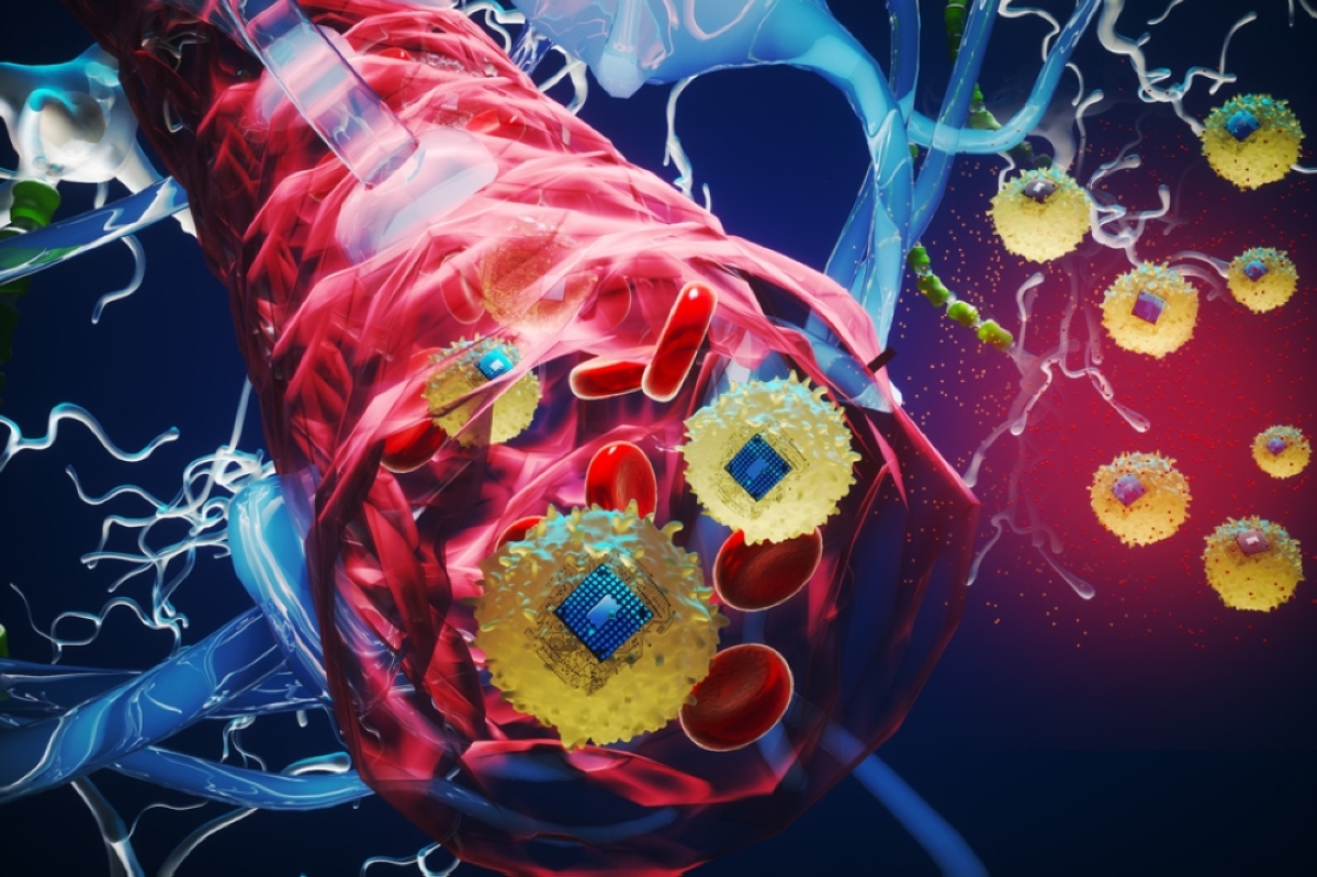 Therapeutic brain implants could eliminate need for surgery - Surgery ...